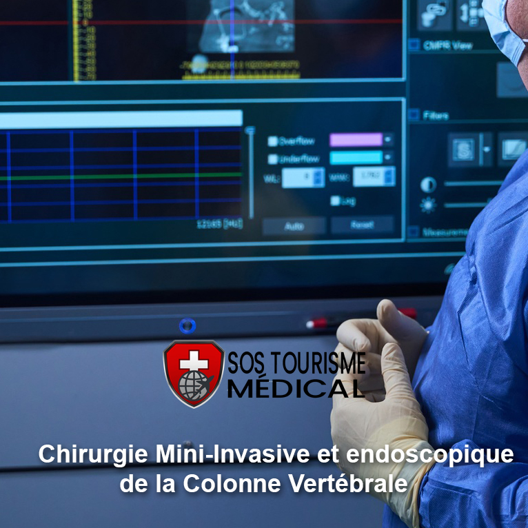 Chirurgie Mini-Invasive Et Endoscopique De La Colonne Vertébrale : L'Avenir Du Mouvement - SOS ...